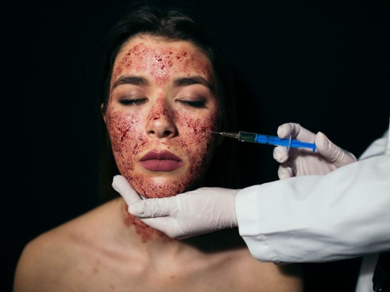 PRP/ Vampire Facial – Skin Nourish Academy